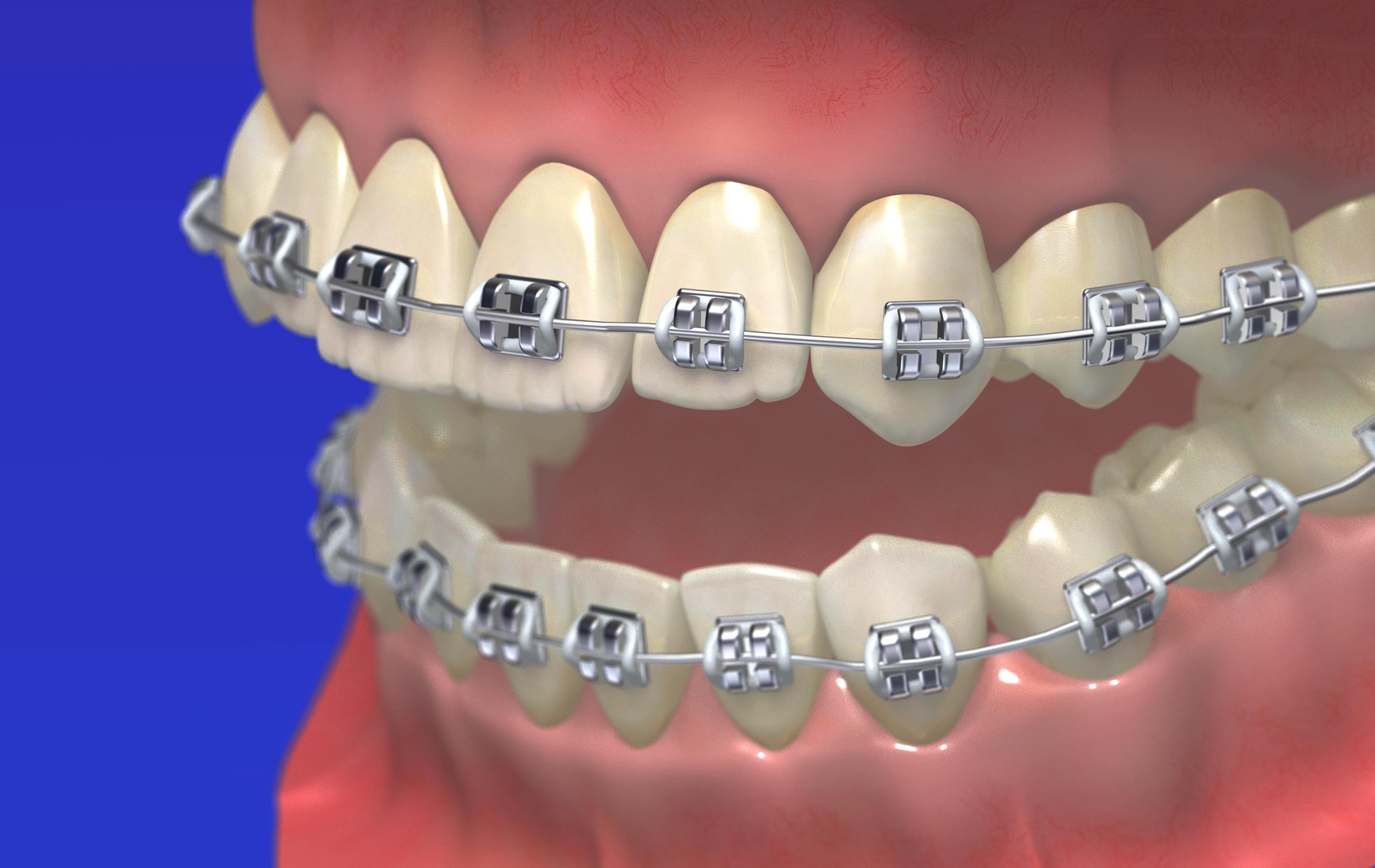 Ortodoncia | Dental Erickson